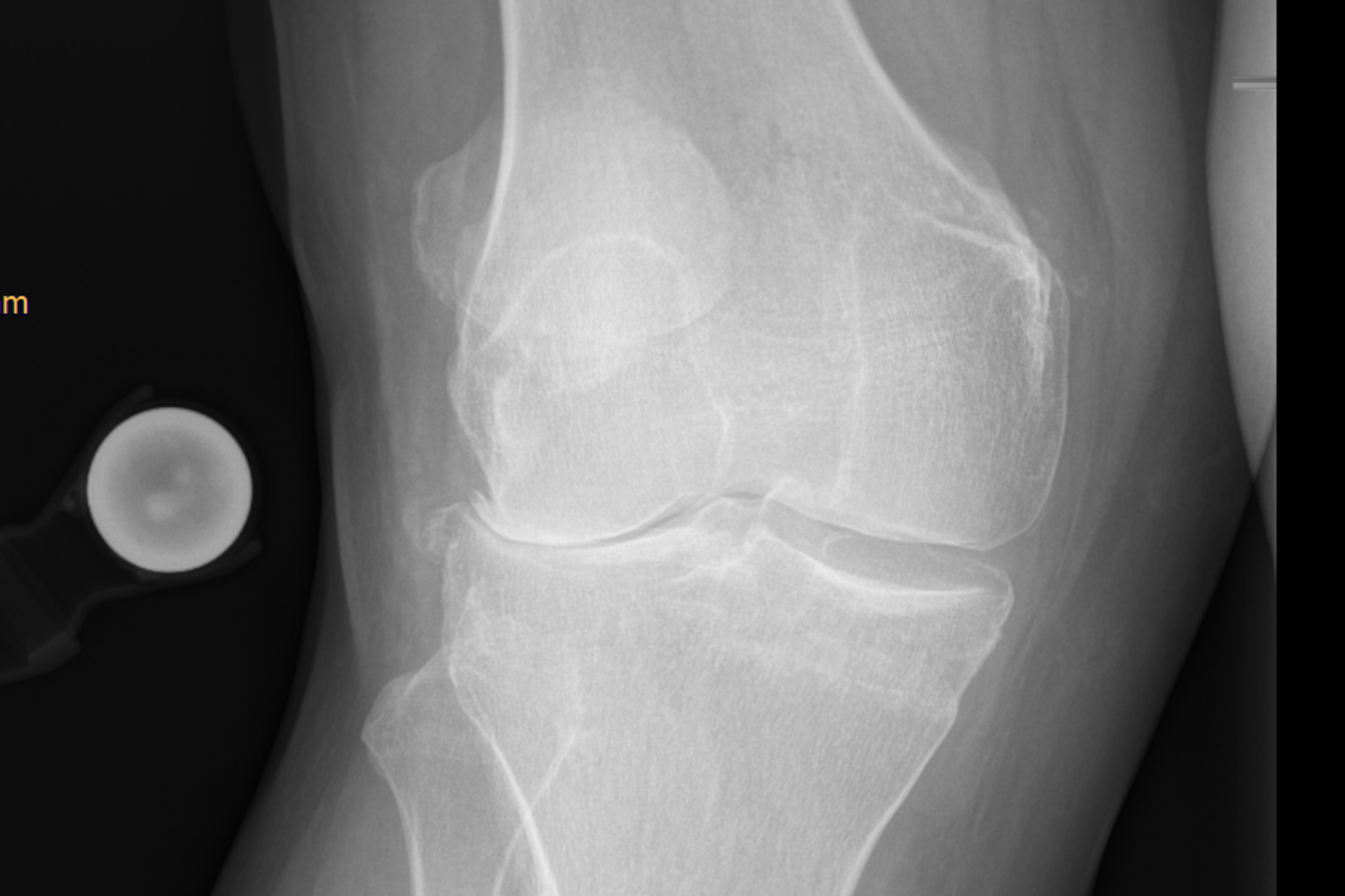 Knie – Dietrich-Bonhoeffer-Klinikum